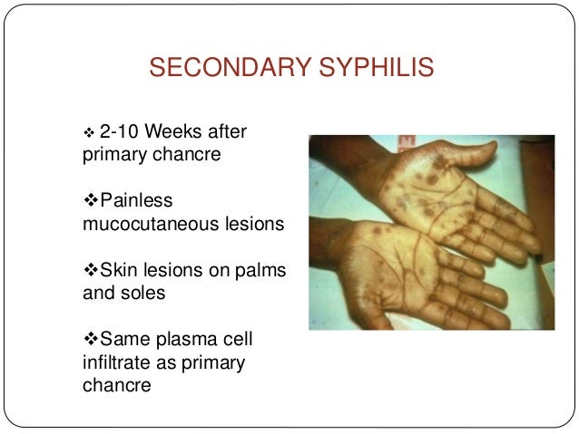 Syphilis