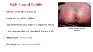 Syphilis in dermatology, clinical features | PPTX