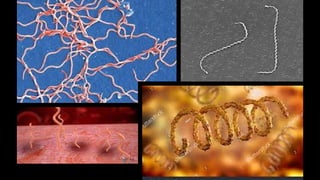 Syphilis complete notes on pathology mode of transmission and etiology ...