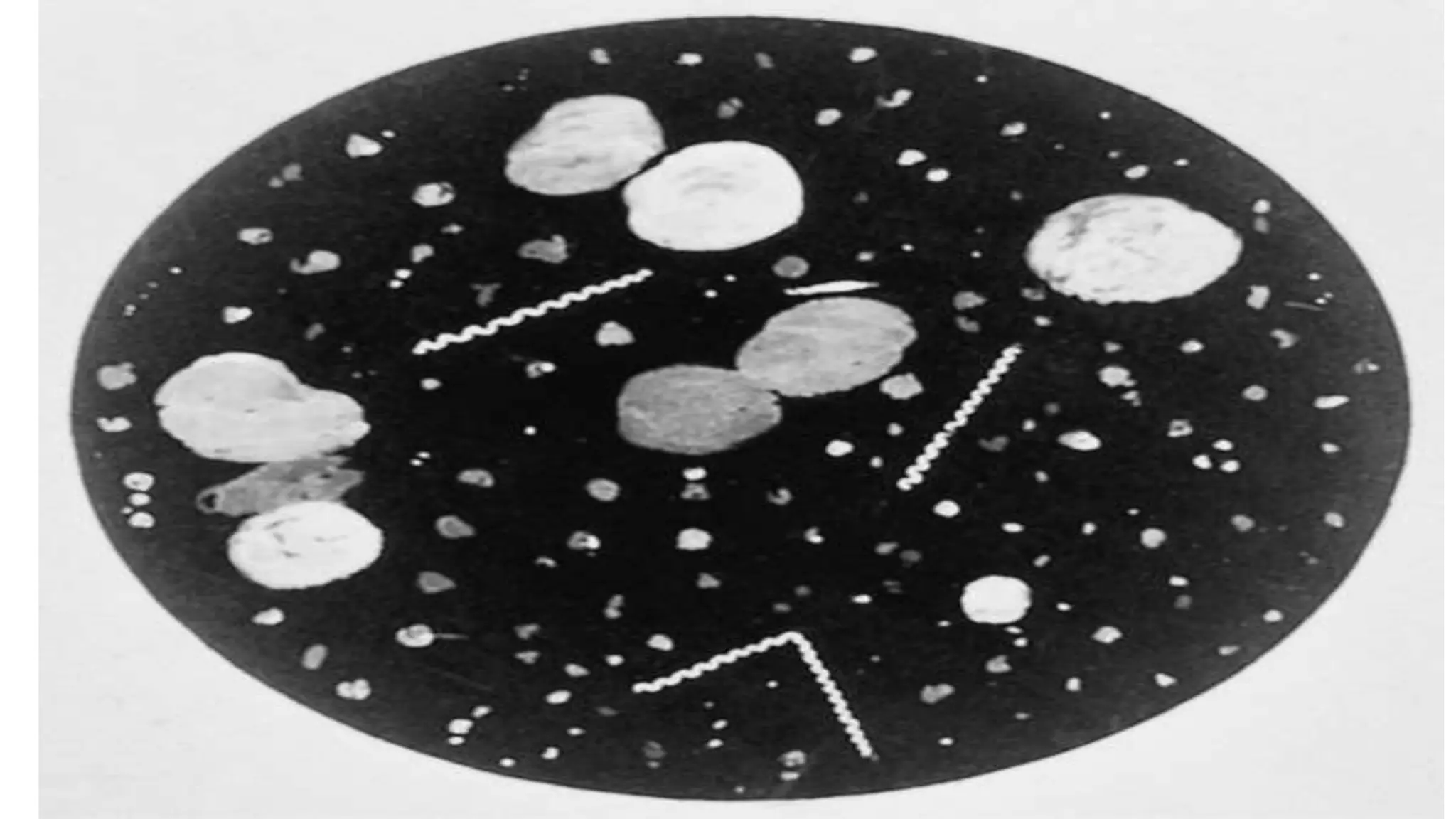 syphilis serology ppt, syphilis, laboratory diagnosis of syphilis, VDRL ...