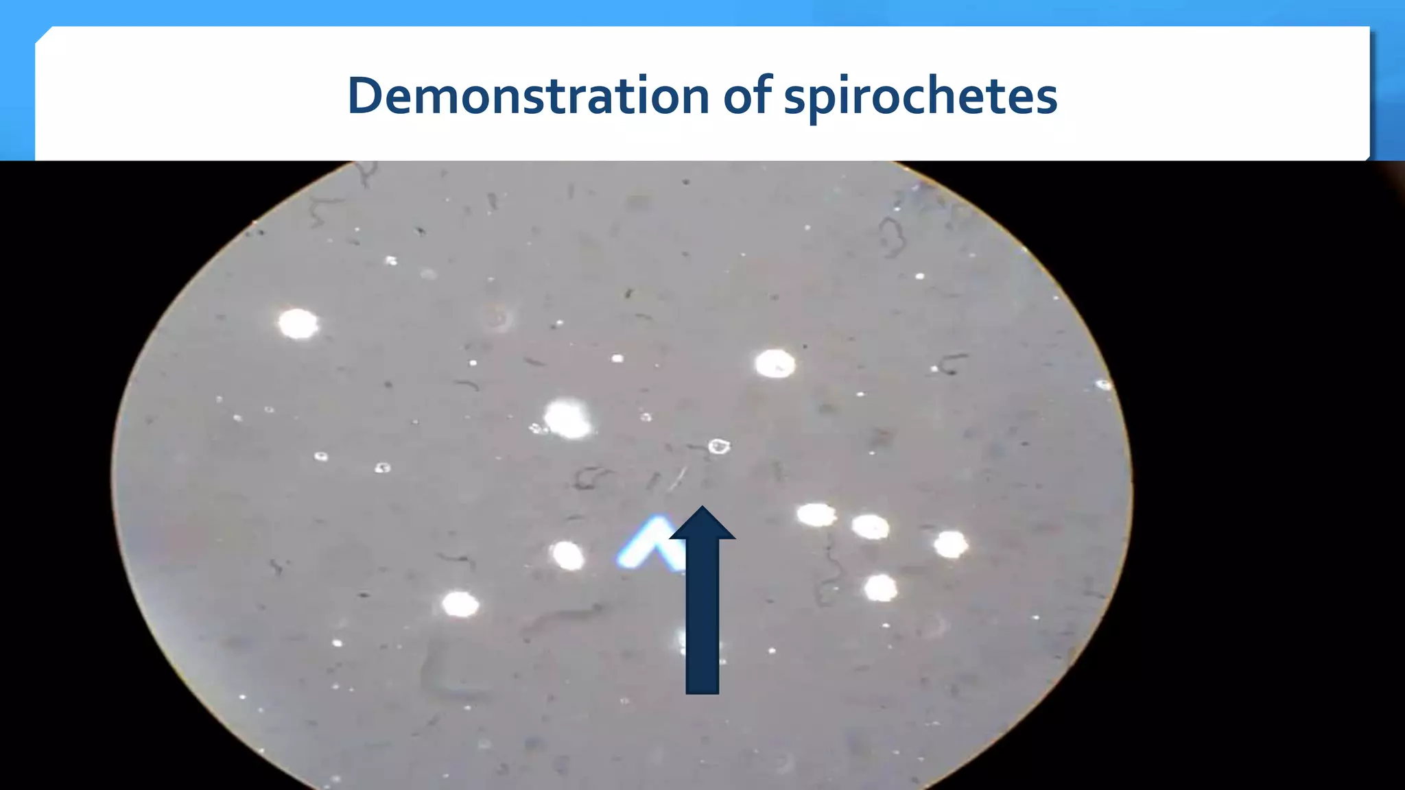 syphilis serology ppt, syphilis, laboratory diagnosis of syphilis, VDRL ...