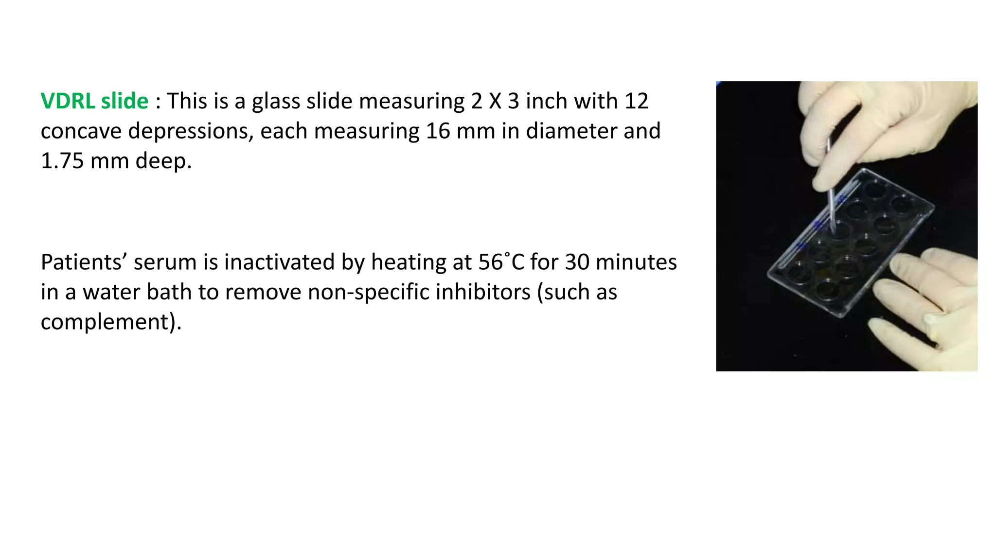 syphilis serology ppt, syphilis, laboratory diagnosis of syphilis, VDRL ...