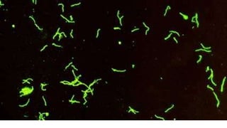 syphilis serology ppt, syphilis, laboratory diagnosis of syphilis, VDRL ...