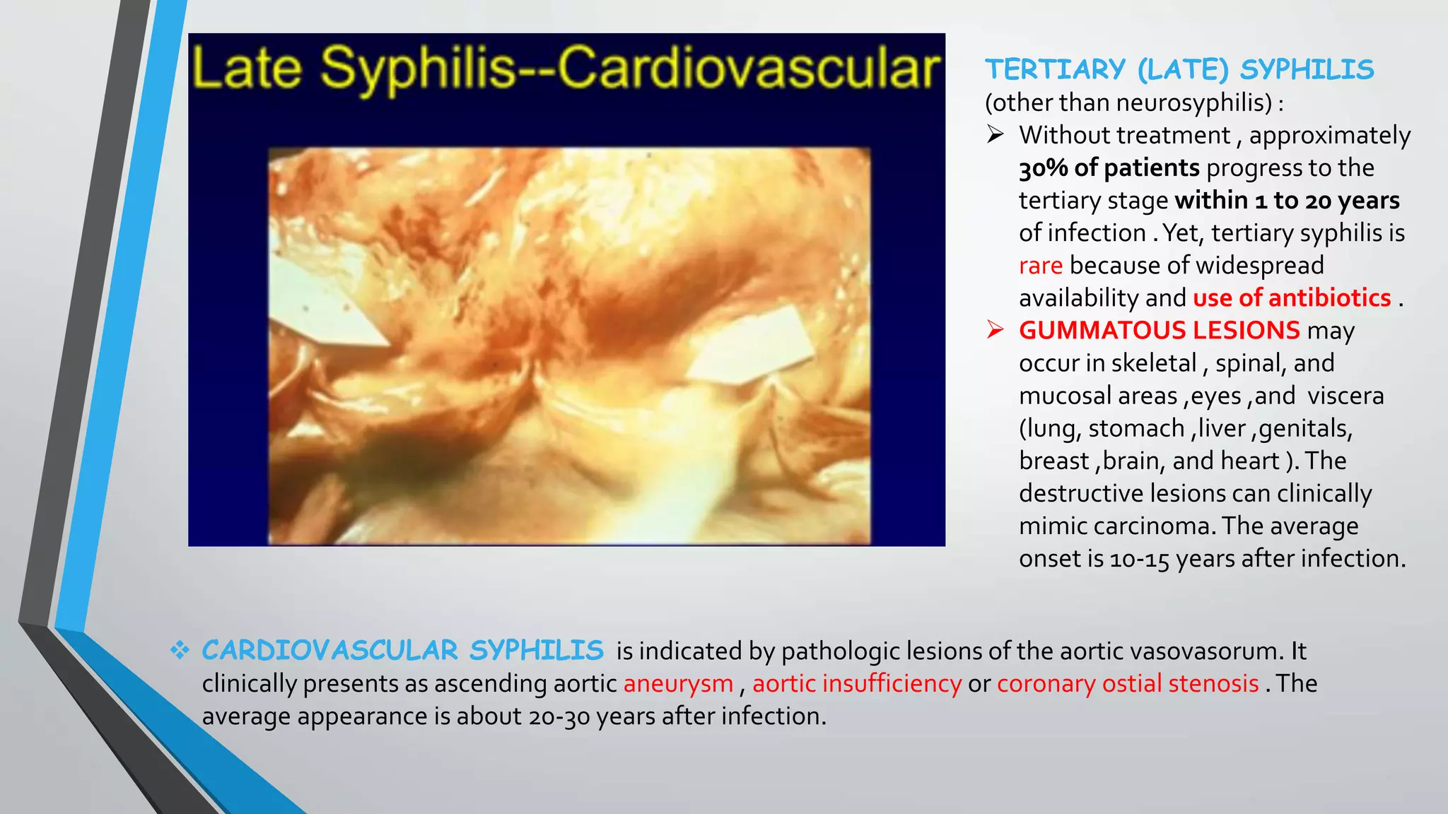 Syphilis -community pharmacy | PPTX