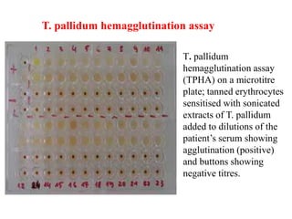 Syphillis Serology.pptx