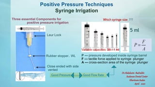 Syringe irrigation [autosaved] | PPT
