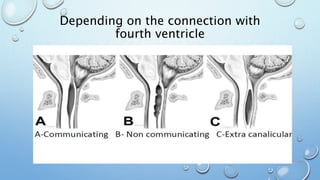 Syringomyelia | PPTX