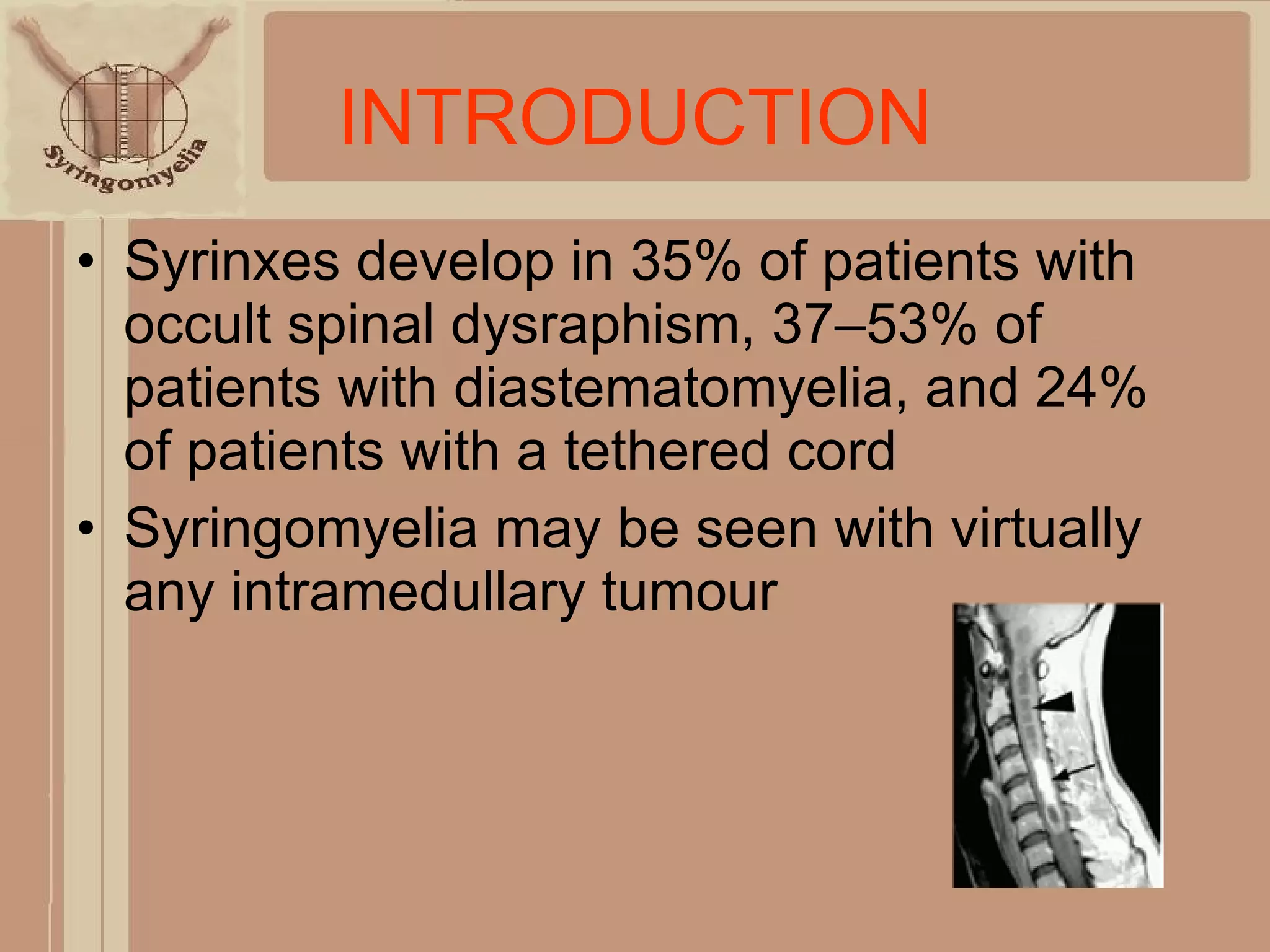 Syringomyelia | PPT | Death, Injury, or Military Conflict | Sensitive ...