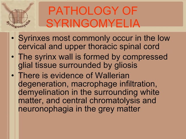 Syringomyelia | PPT | Death, Injury, or Military Conflict | Sensitive ...