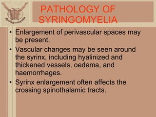 Syringomyelia | PPT