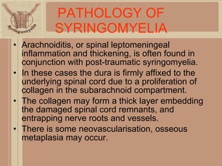 Syringomyelia | PPT