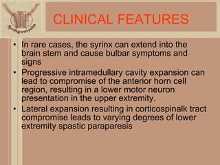 Syringomyelia | PPT