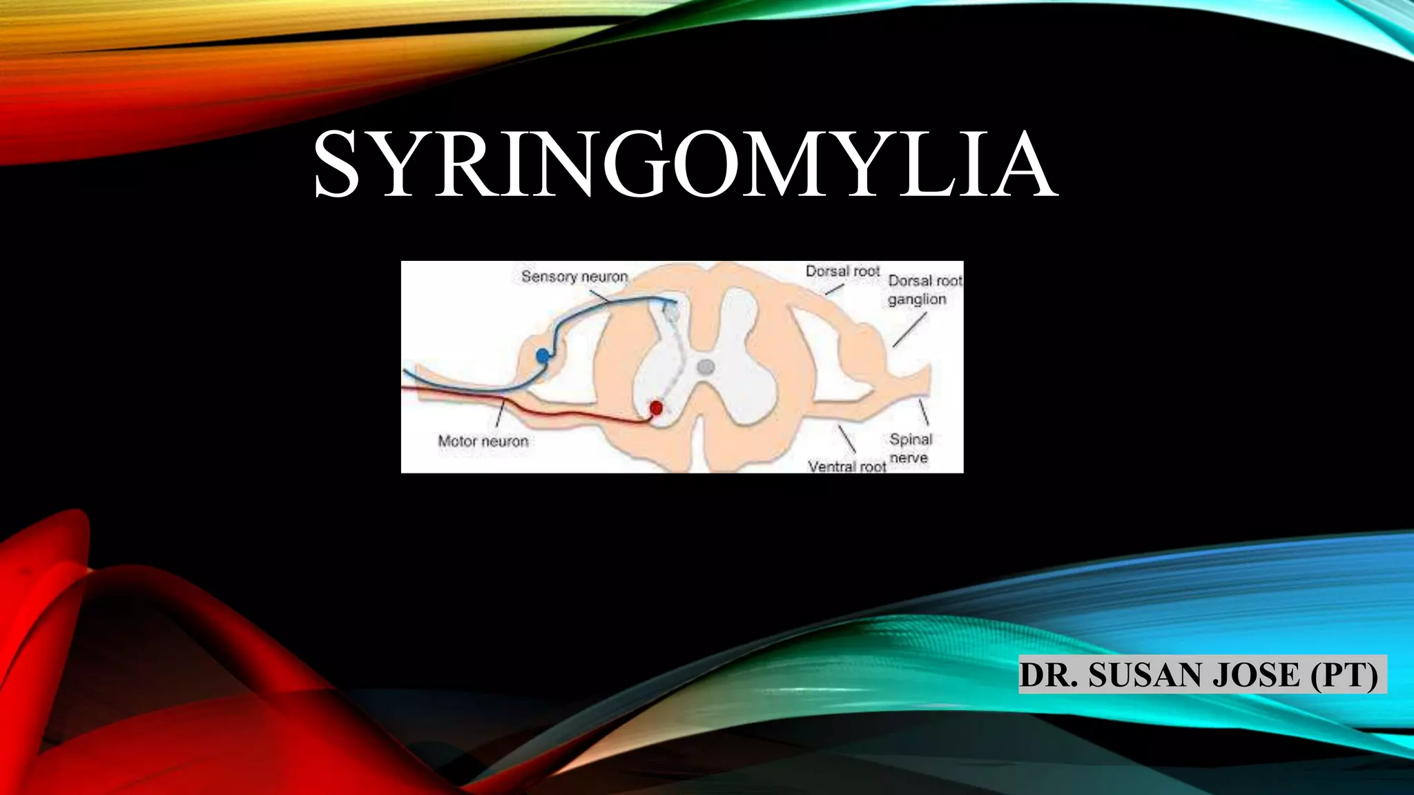 Syringomylia Physiotherapy Percpective.pptx