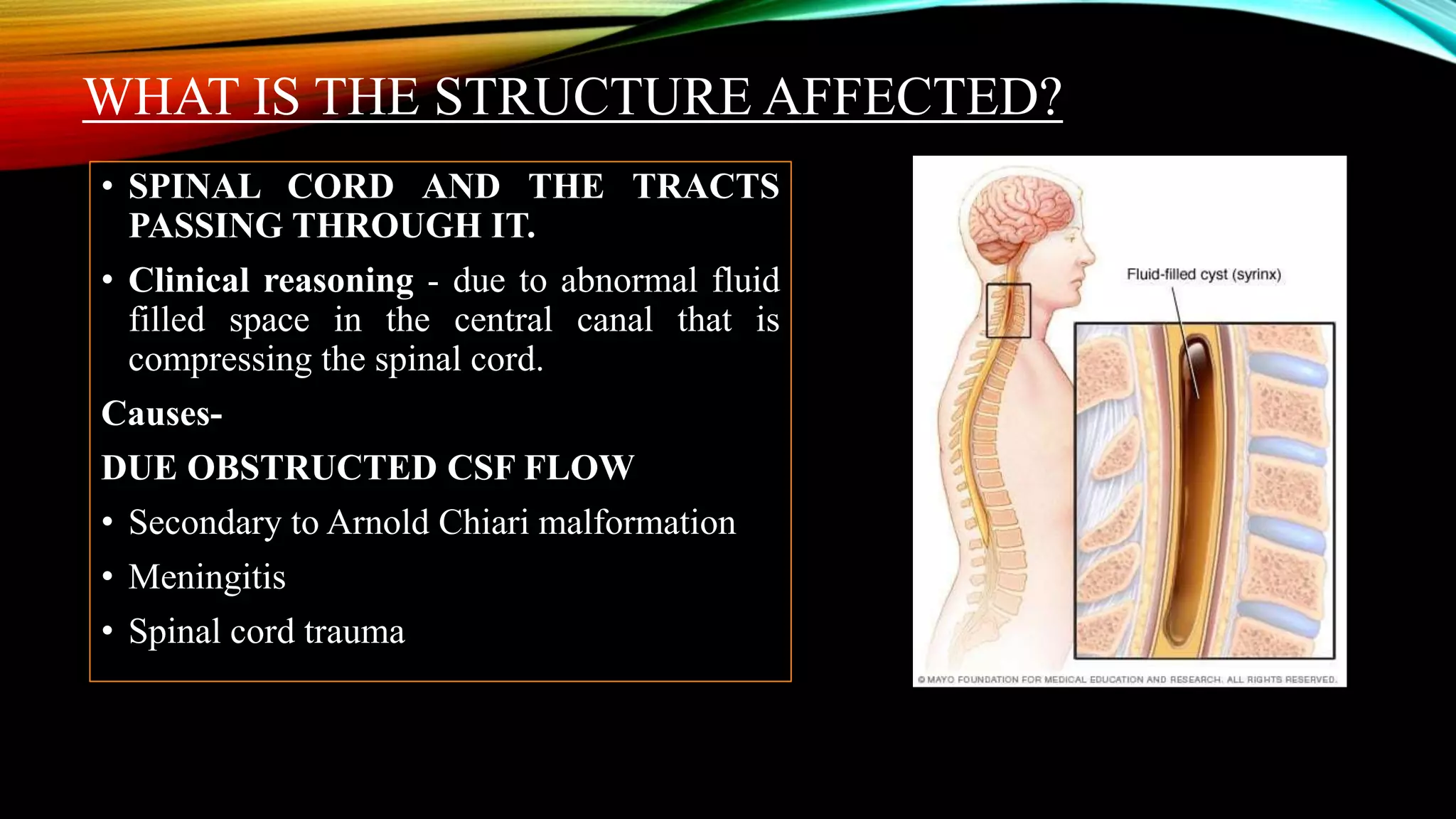 Syringomylia Physiotherapy Percpective.pptx