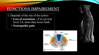 Syringomylia Physiotherapy Percpective.pptx