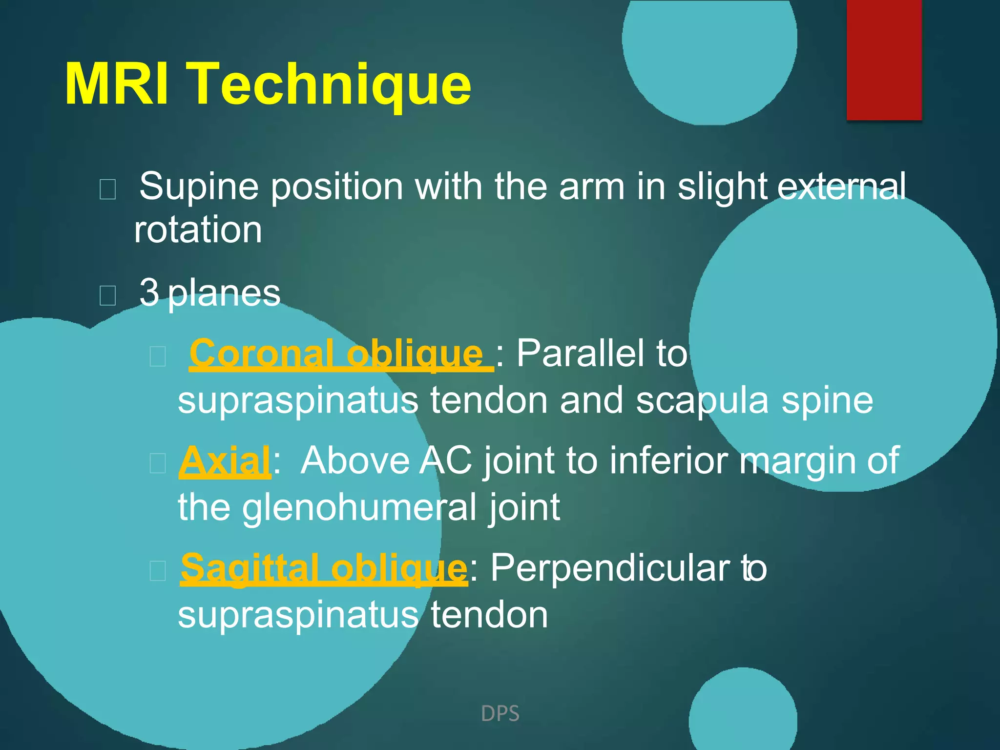 Systematic interpretation of shoulder MRI: DR. D. P. SWAMI | PPTX