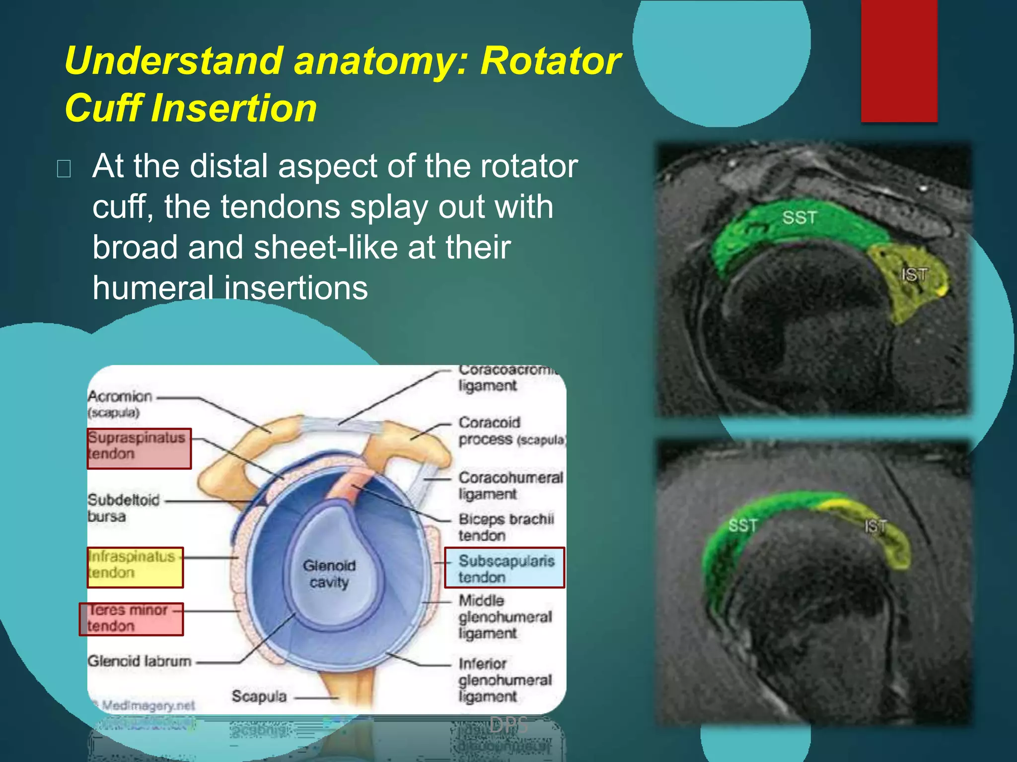Systematic interpretation of shoulder MRI: DR. D. P. SWAMI | PPTX