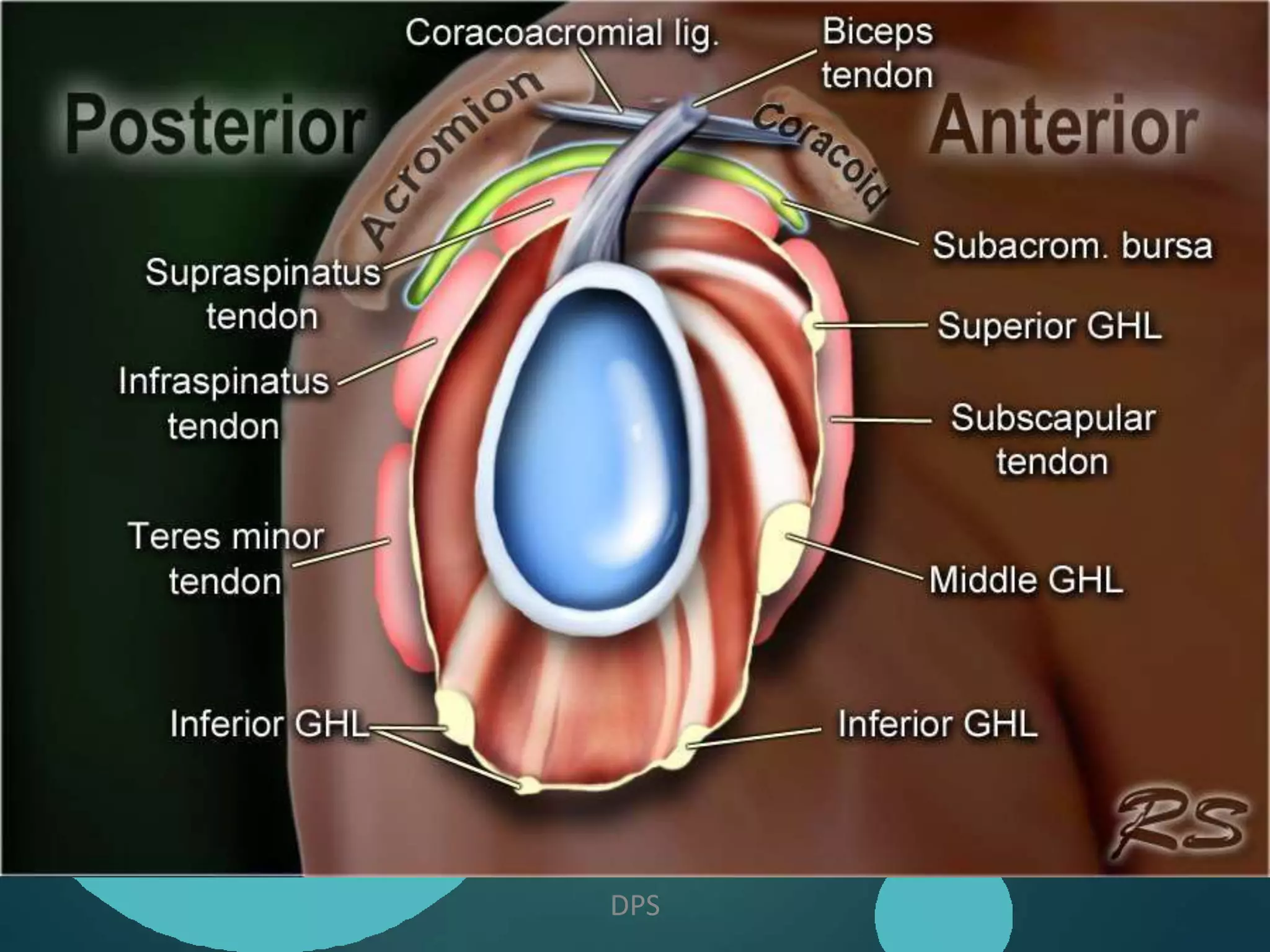 Systematic interpretation of shoulder MRI: DR. D. P. SWAMI | PPTX