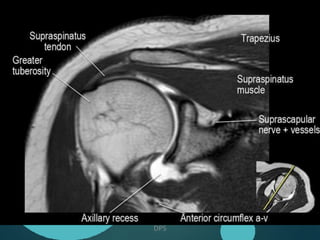 Systematic interpretation of shoulder MRI: DR. D. P. SWAMI | PPTX