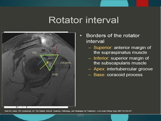 Systematic interpretation of shoulder MRI: DR. D. P. SWAMI | PPTX