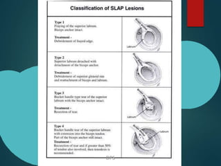 Systematic interpretation of shoulder MRI: DR. D. P. SWAMI | PPTX