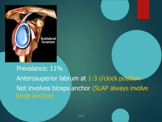 Systematic interpretation of shoulder MRI: DR. D. P. SWAMI | PPTX
