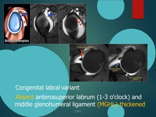 Systematic interpretation of shoulder MRI: DR. D. P. SWAMI | PPTX