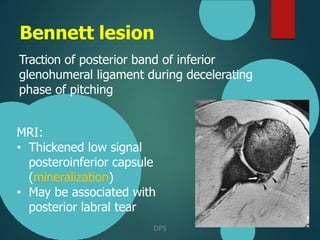 Systematic interpretation of shoulder MRI: DR. D. P. SWAMI | PPT