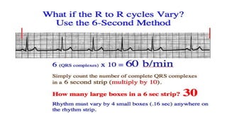 Systematic Approach in Interpretation of Normal ECG.pptx