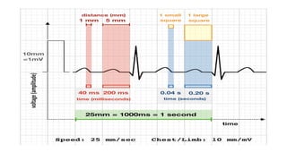 Systematic Approach in Interpretation of Normal ECG.pptx