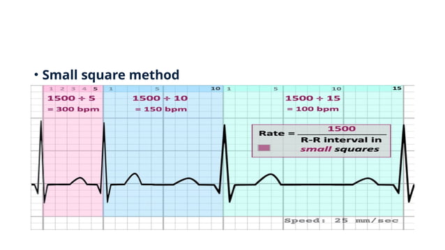 Systematic Approach in Interpretation of Normal ECG.pptx