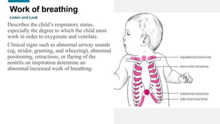 Systematic approach to the seriously ill or injured child | PPTX