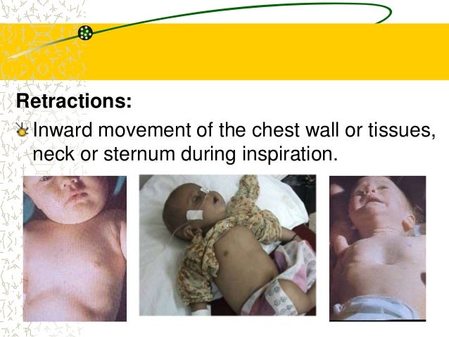 Systematic approach to the seriously ill or injured child AG
