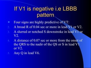 Systematic approach to wide qrs tachycardia | PPT