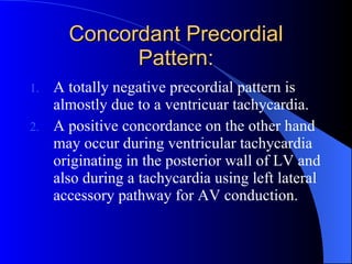 Systematic approach to wide qrs tachycardia | PPT