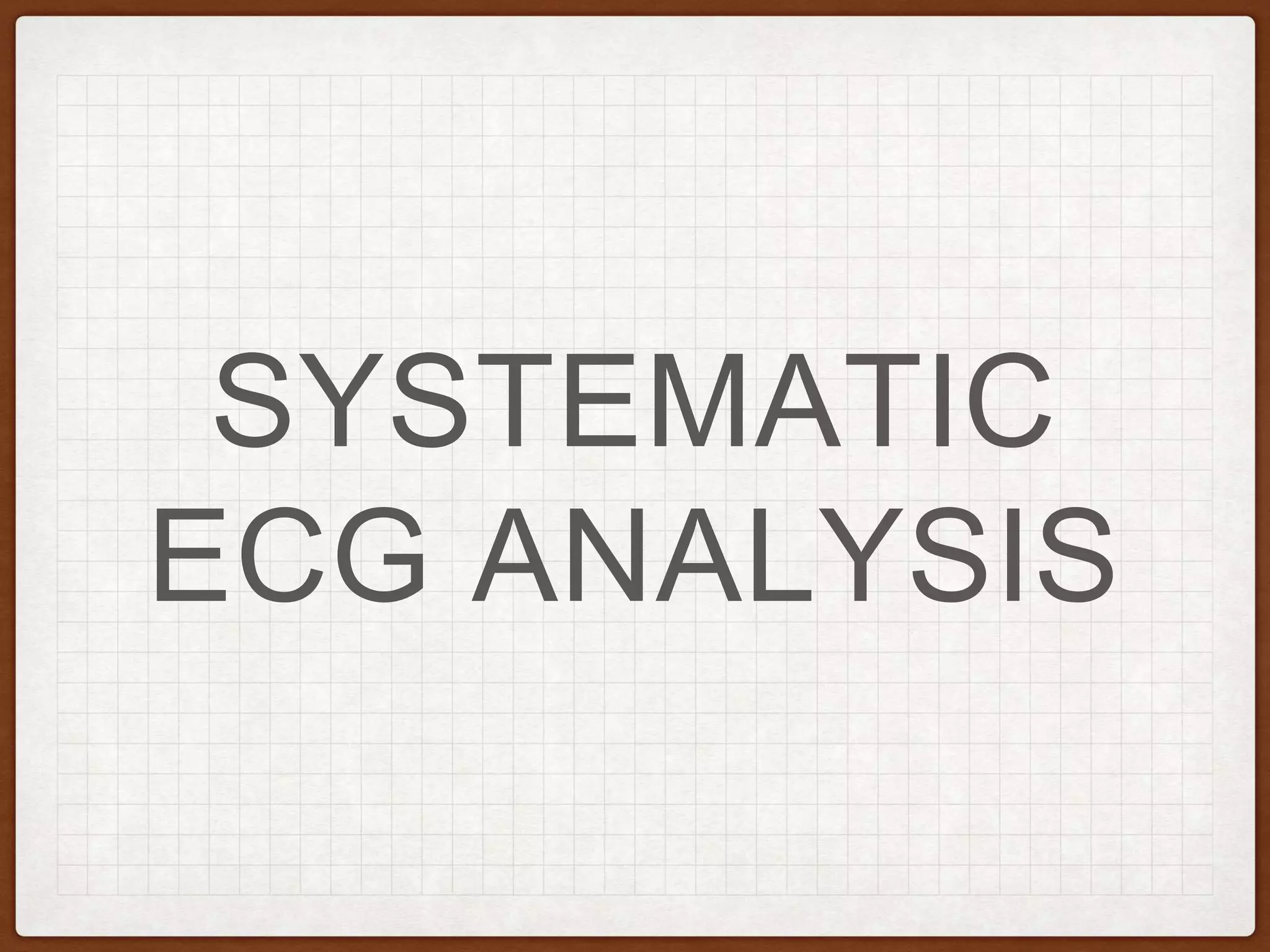 Systematic ECG analysis | PPTX