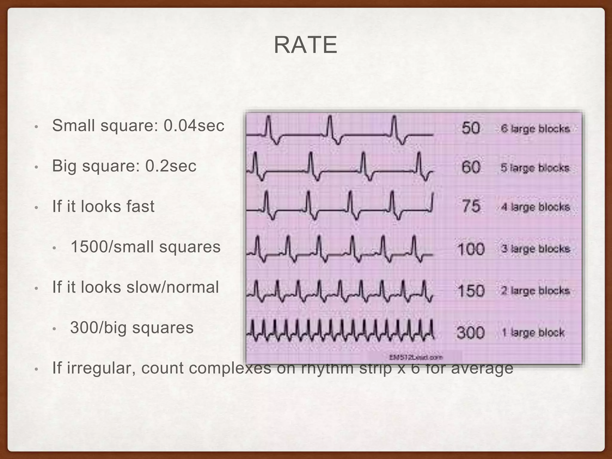 Systematic ECG analysis | PPTX
