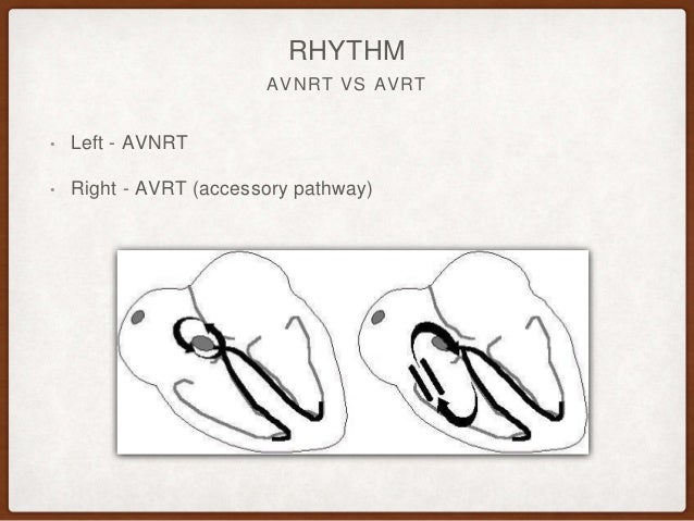 Systematic ECG analysis