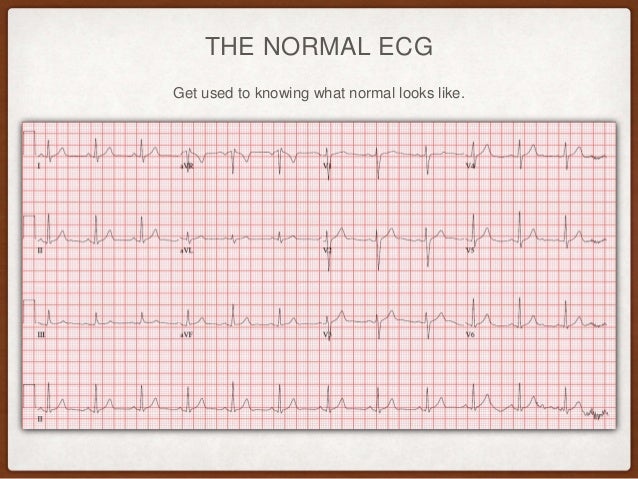 Systematic ECG Analysis systematic-ecg-analysis