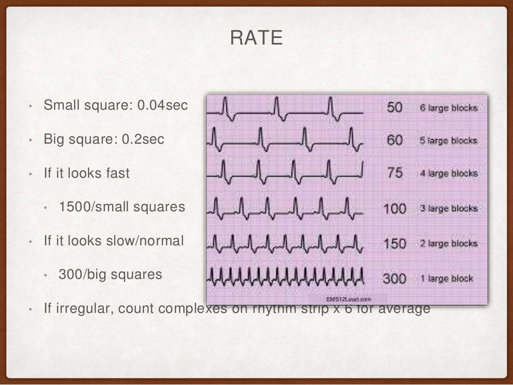 Systematic ECG analysis