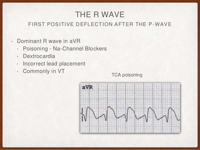 Systematic ECG analysis