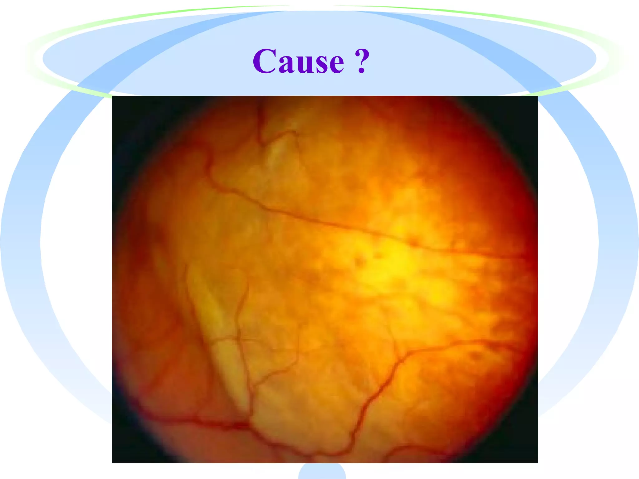 Systematic fundus examination | PPT
