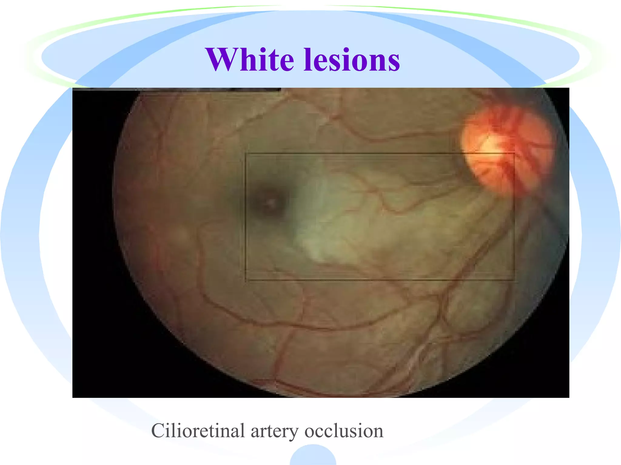 Systematic fundus examination | PPT