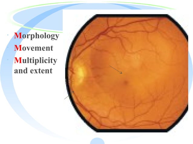 Systematic fundus examination | PPT