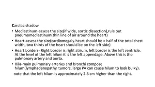 Systematic method for reading chest x rays | PPTX
