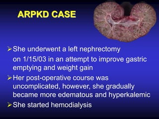 Systemic-Hypertension-and-Renal-transplantation-in-ARPKD.ppt