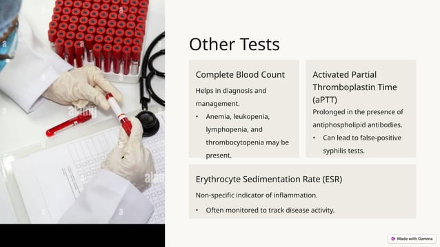 Systemic-Lupus-Erythematosus-Diagnosis-and-Management (1).pptx