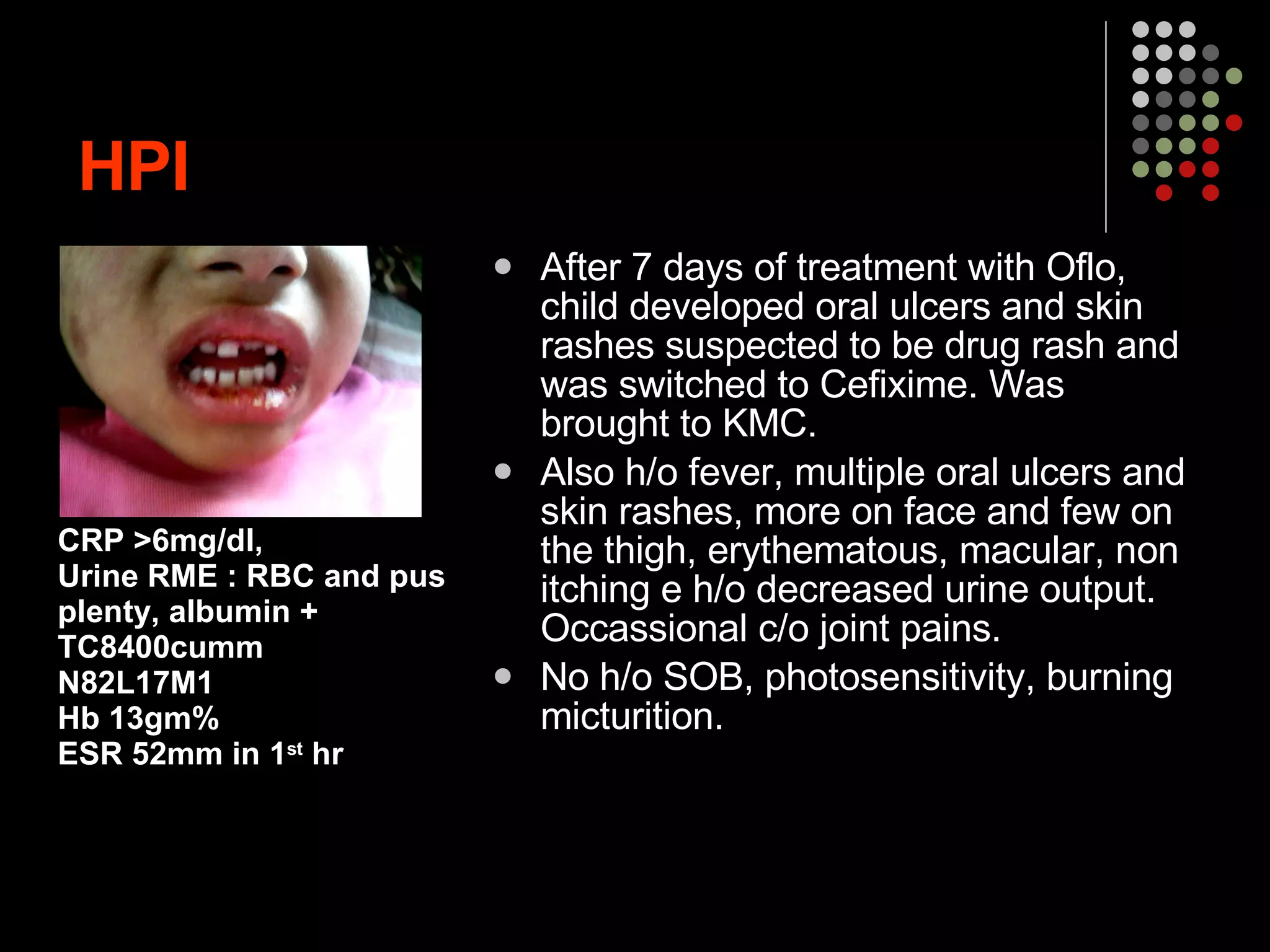 Systemic Lupus Erythematosus | POT