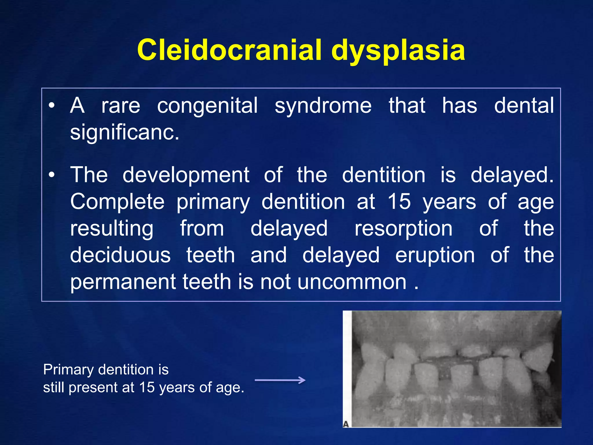 Systemic and congenital factors that influence the process of eruption ...