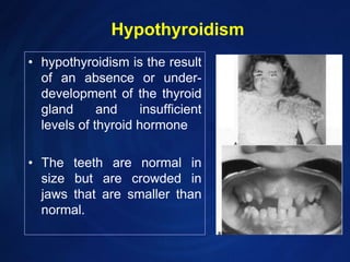 Systemic and congenital factors that influence the process of eruption ...